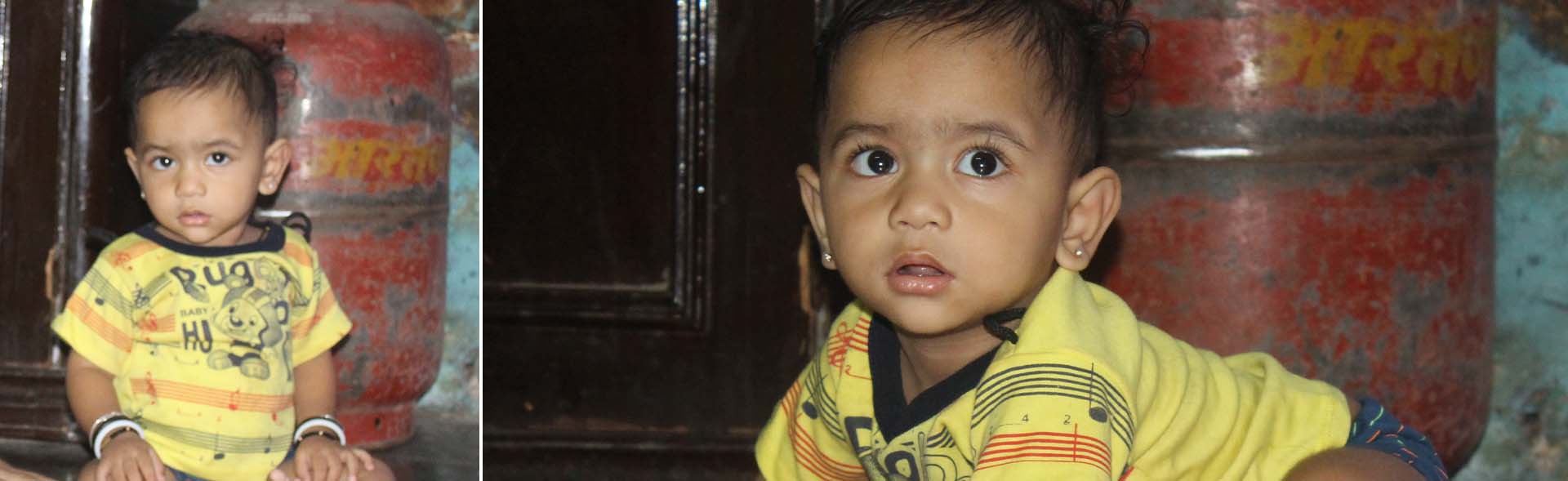 Project Vishwaas: Gifting a 'BREATH OF HOPE' for Little Suhel - Bal ...